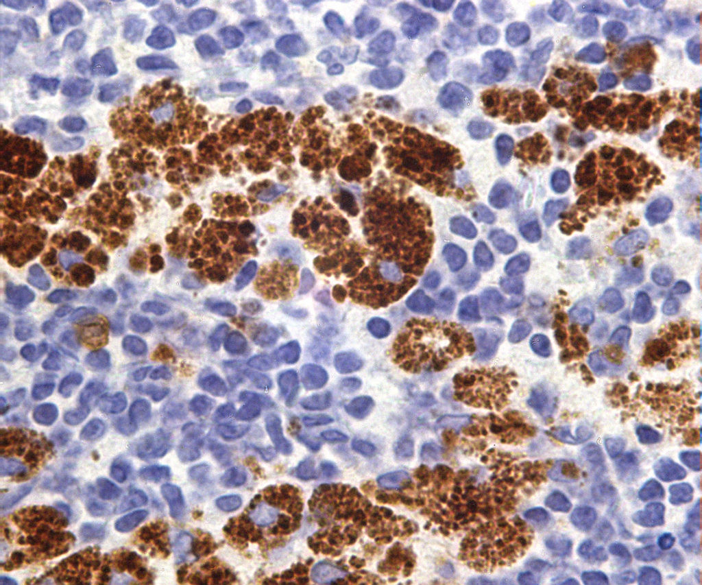 Pattern of staining – Antibody Lexicon