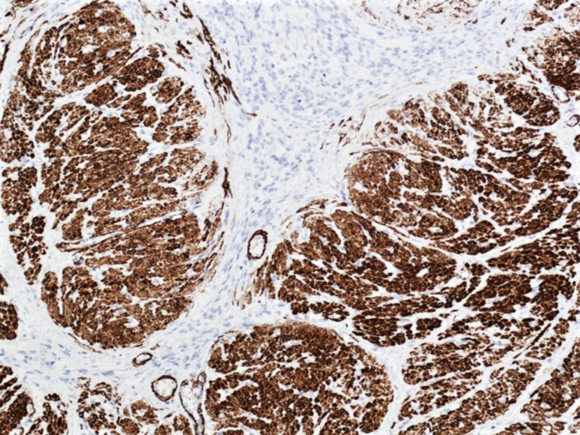 H-Caldesmon – Antibody Lexicon