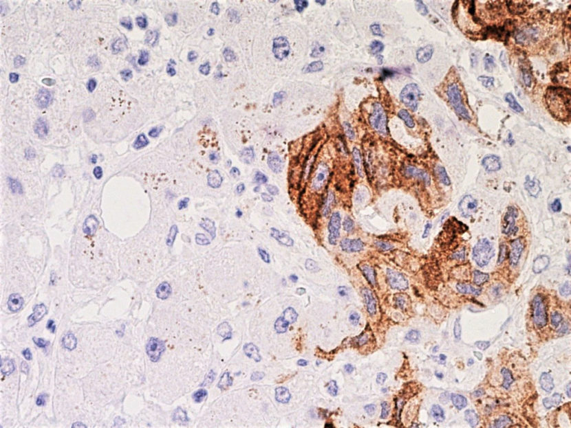 Glypican 3 – Antibody Lexicon
