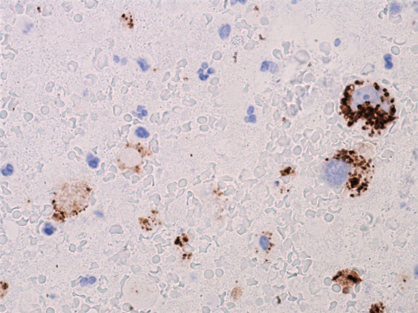 Napsin A – Antibody Lexicon