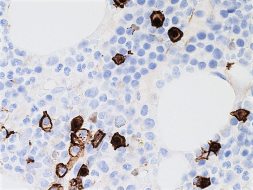 CD138 – Antibody Lexicon