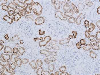 Napsin A – Antibody Lexicon