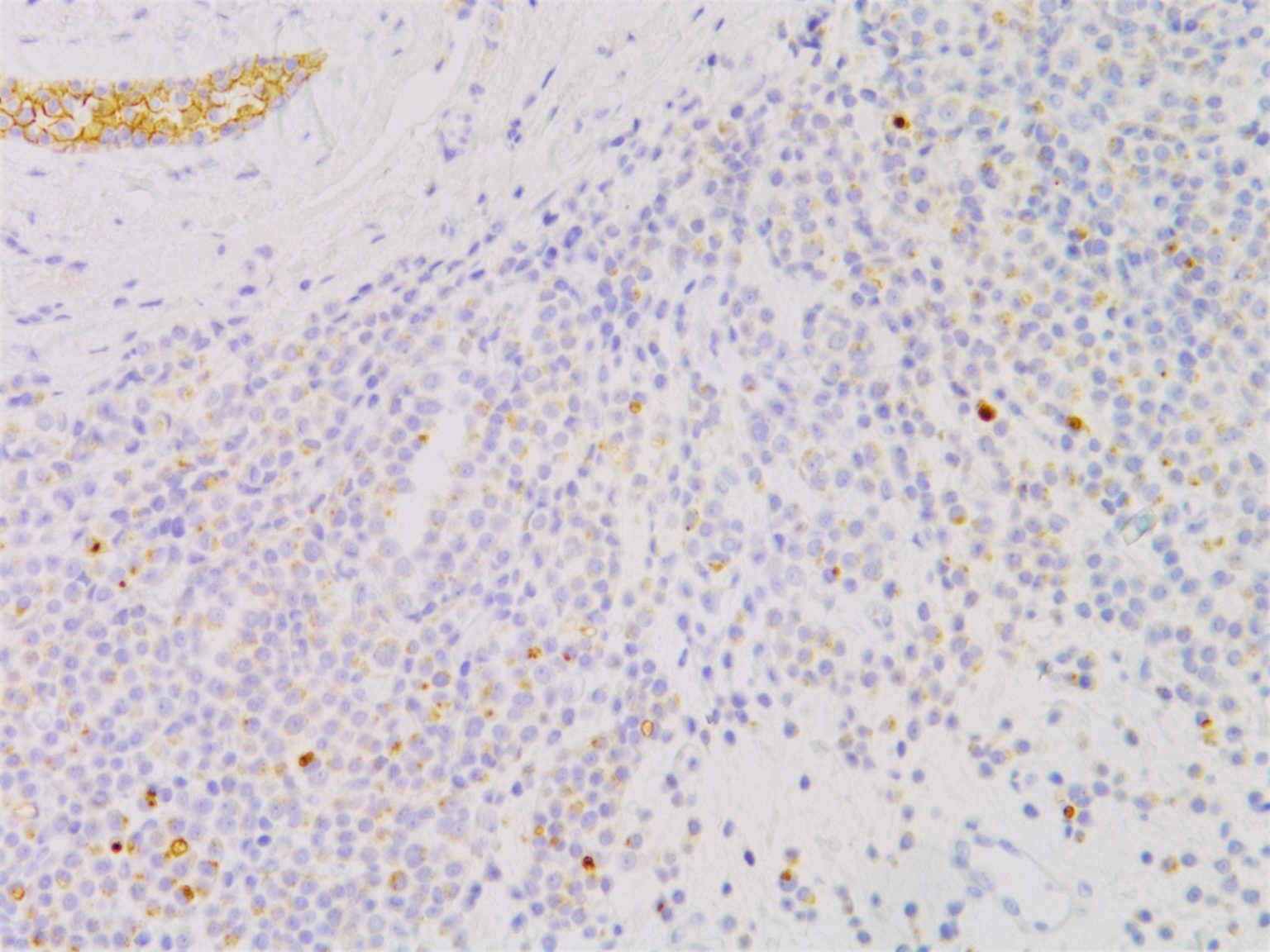 Pattern of staining – Antibody Lexicon