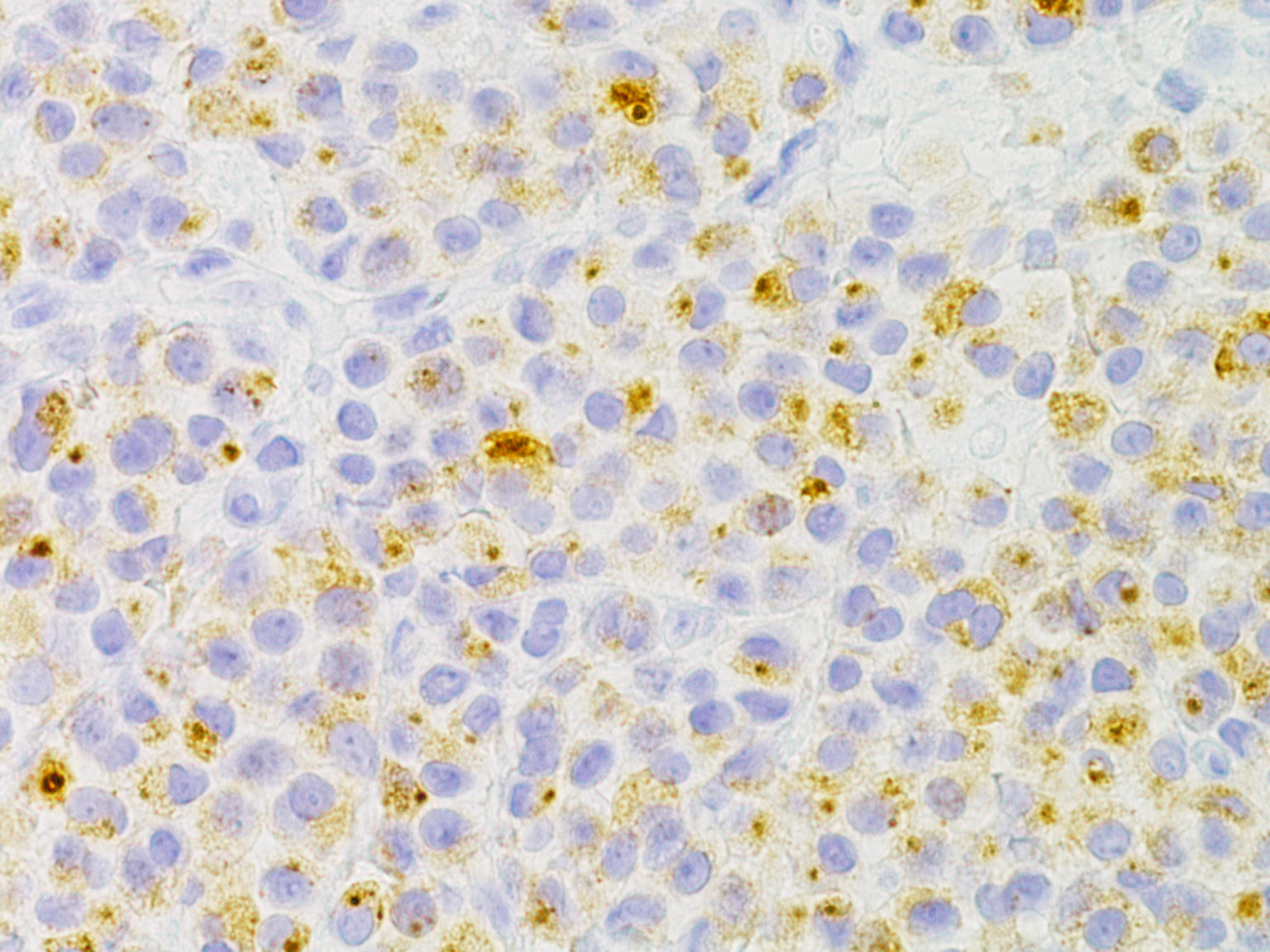 Pattern of staining – Antibody Lexicon