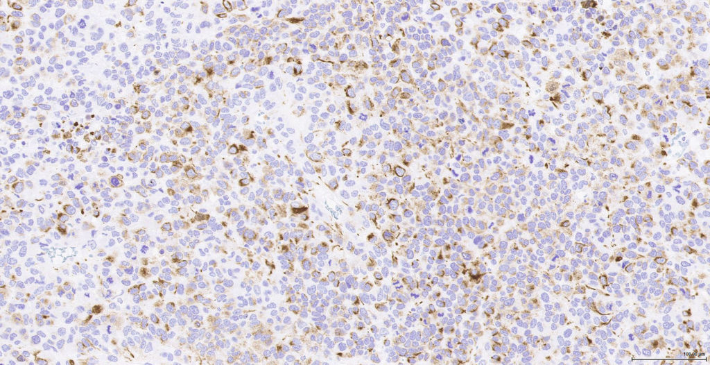 Artefacts and pitfalls under staining and interpretation – Antibody Lexicon