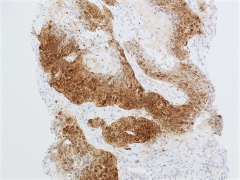 P16 – Antibody Lexicon