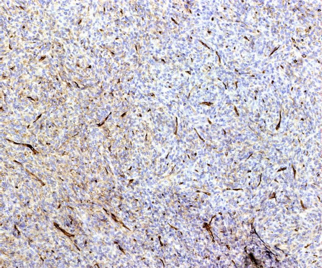 Appropriate tissue block – Antibody Lexicon