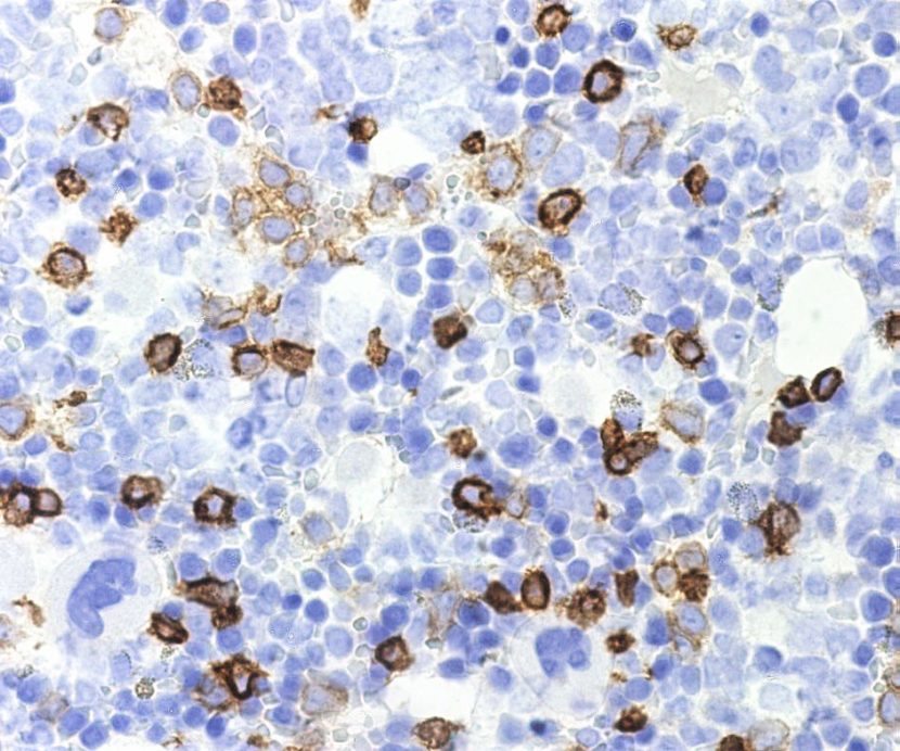 Intensity of staining – Antibody Lexicon