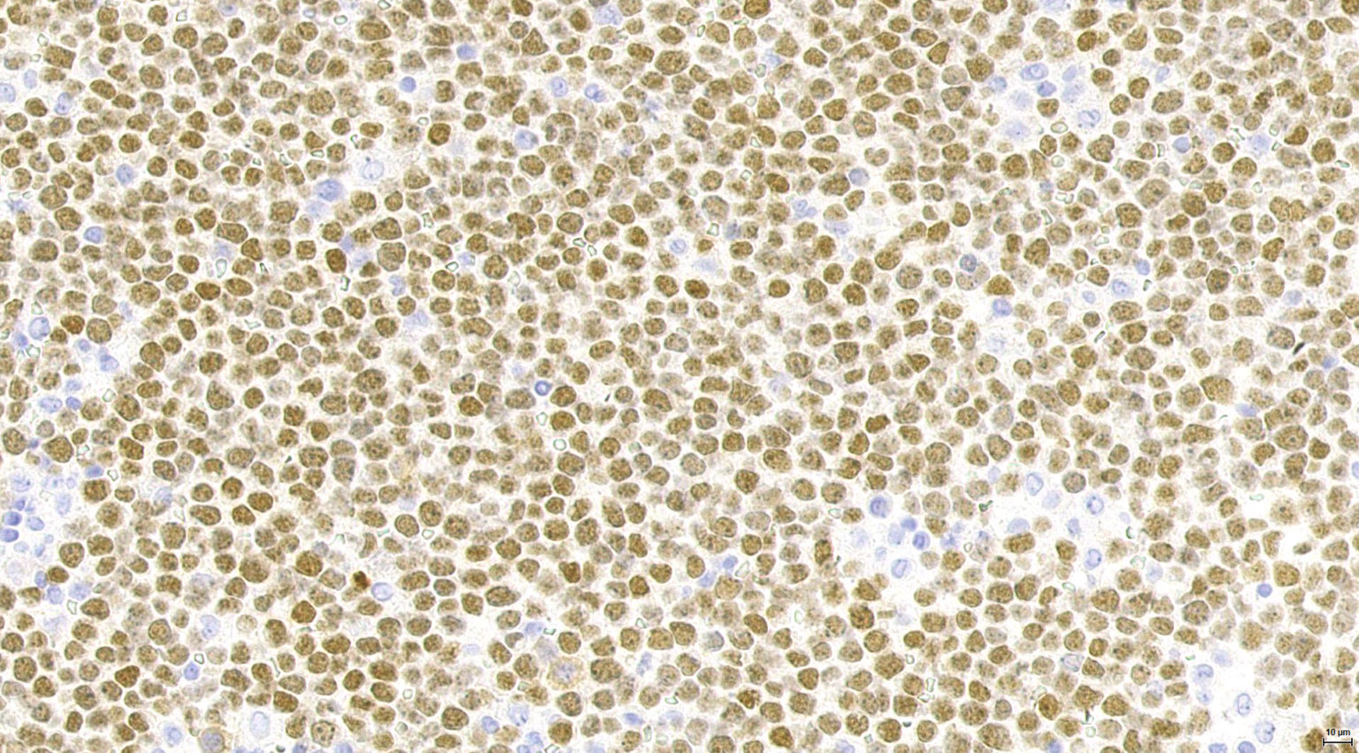 Adequate antibody panel – Antibody Lexicon