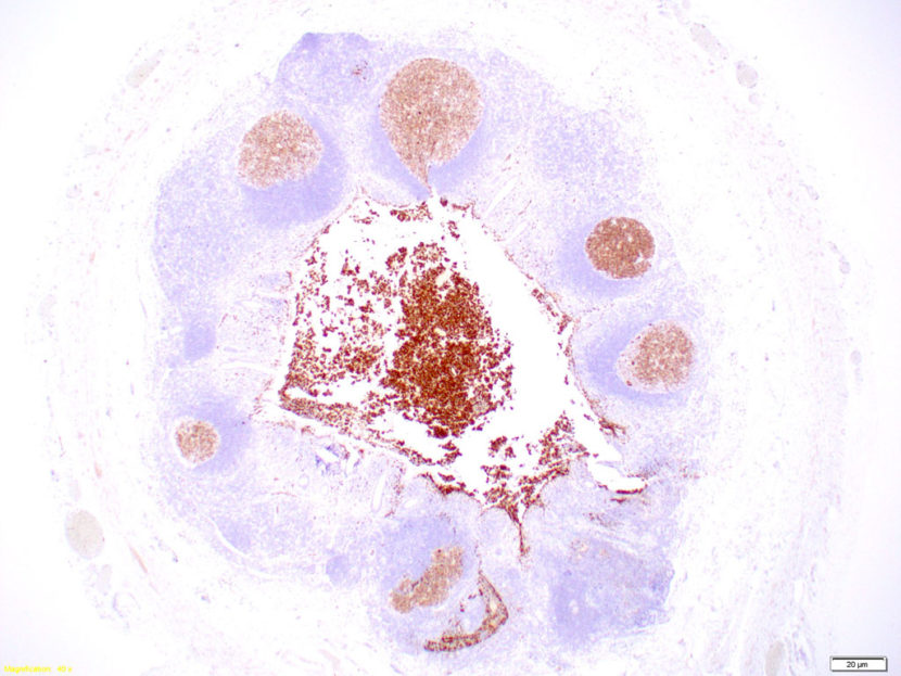 CD10 – Antibody Lexicon
