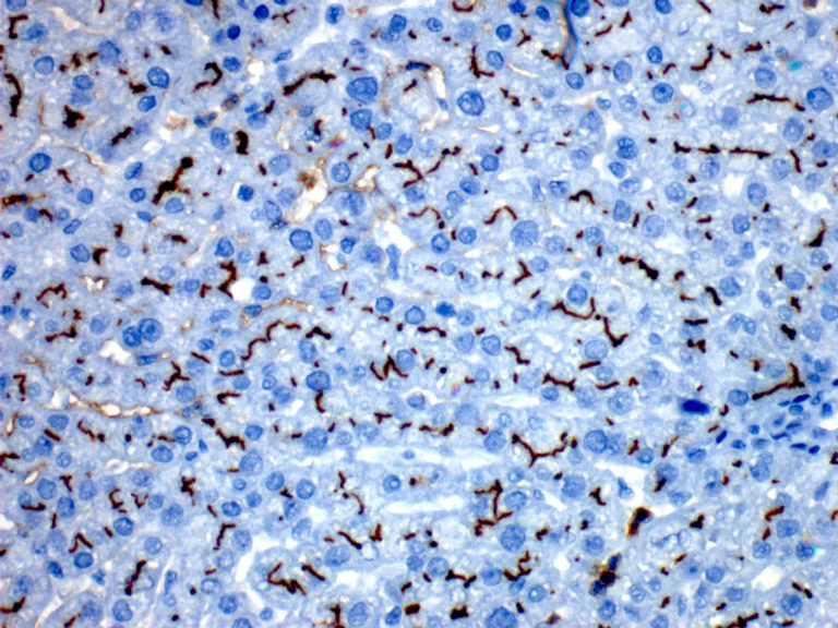CD10 – Antibody Lexicon