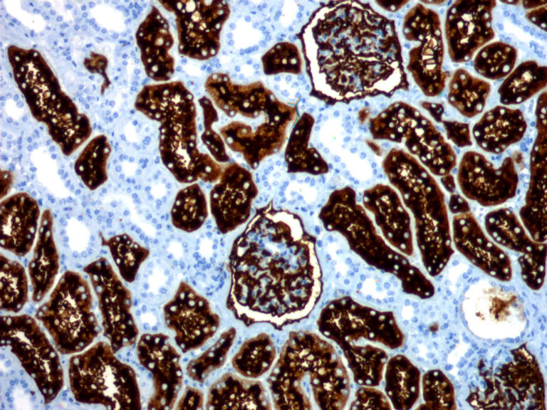CD10 – Antibody Lexicon