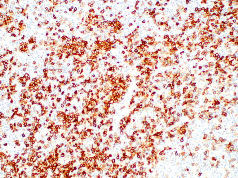 CD10 – Antibody Lexicon