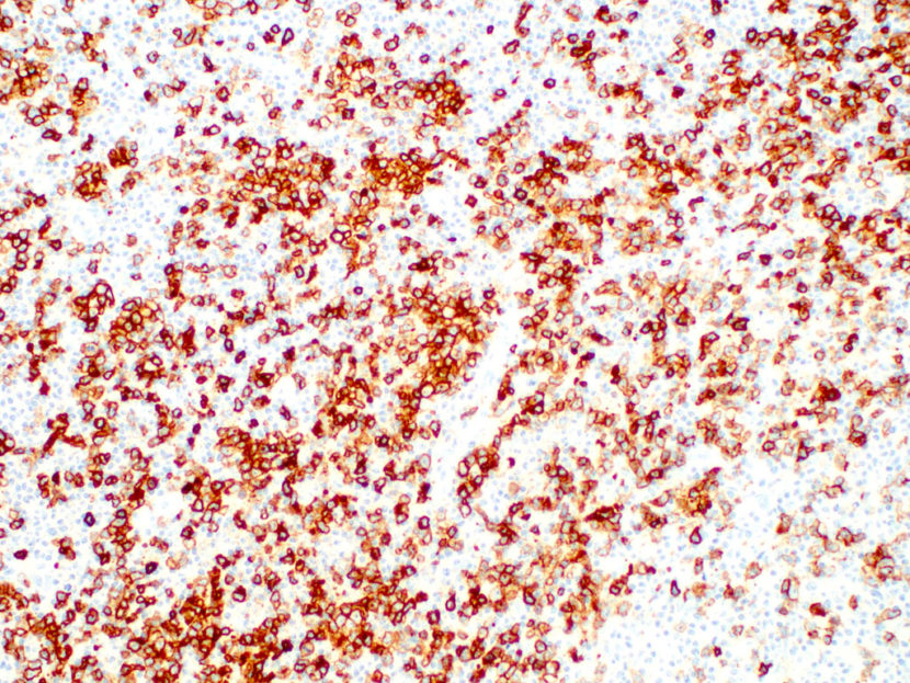 CD10 – Antibody Lexicon