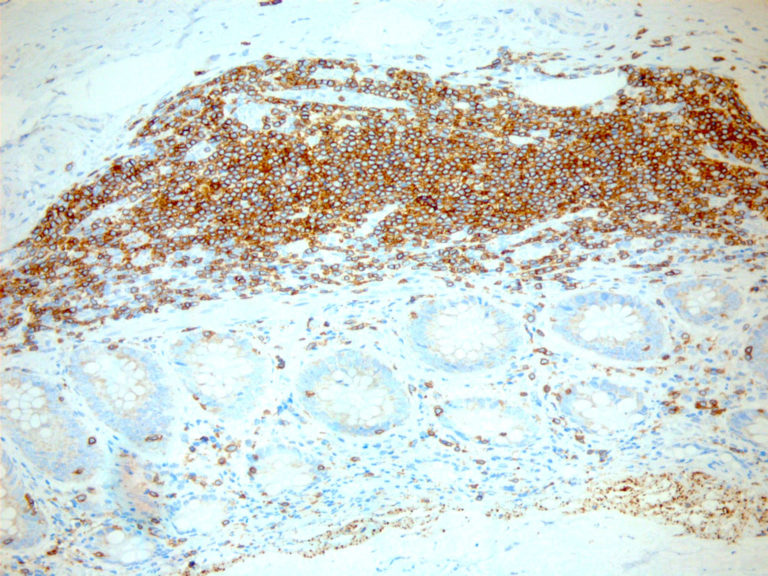 CD3 – Antibody Lexicon