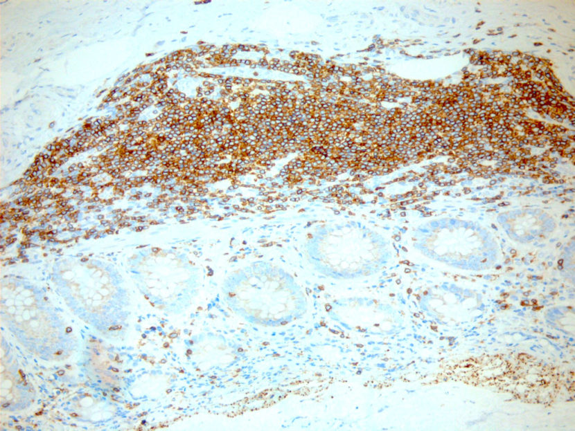 CD3 – Antibody Lexicon