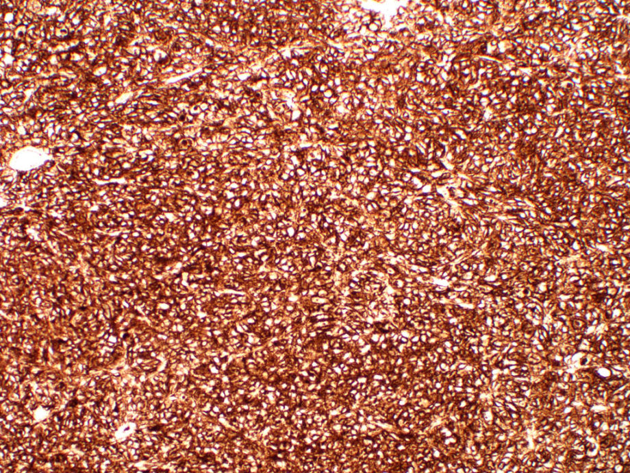 CD21- – Antibody Lexicon