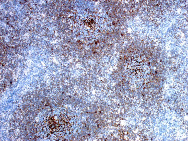 CD21- – Antibody Lexicon