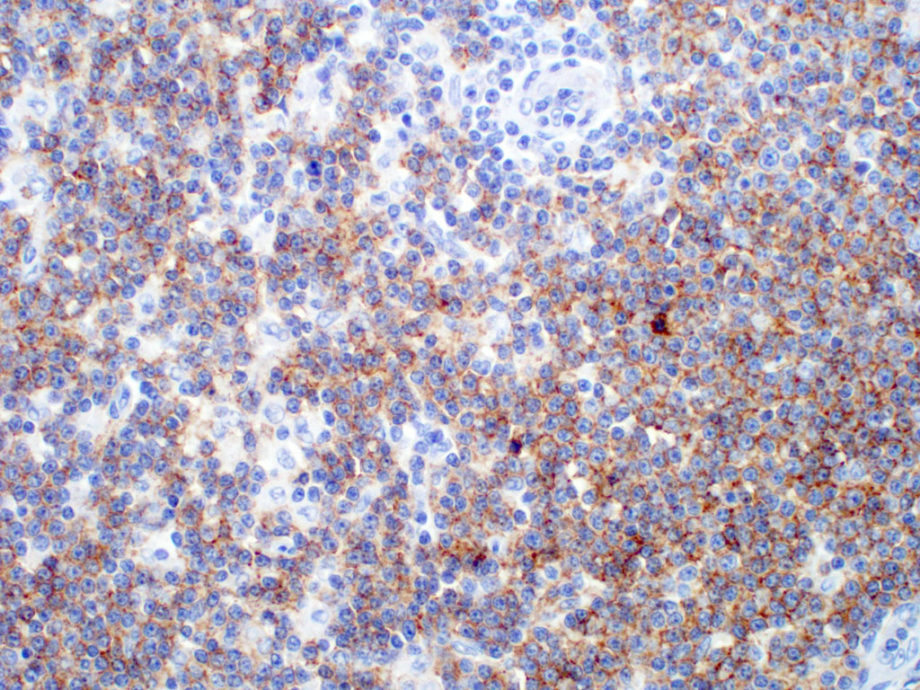 CD21- – Antibody Lexicon