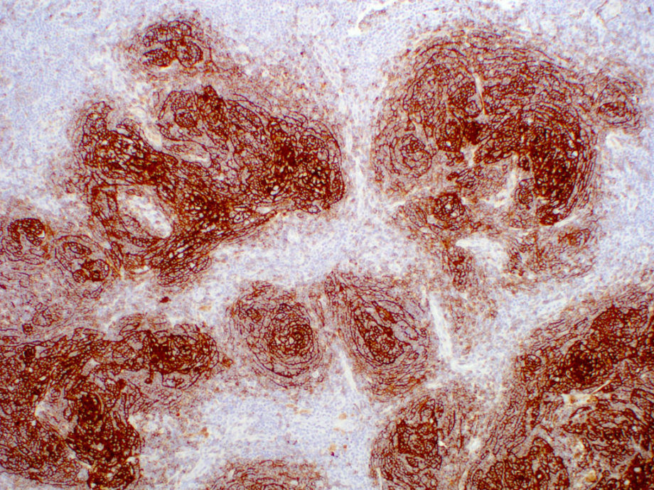 CD21- – Antibody Lexicon