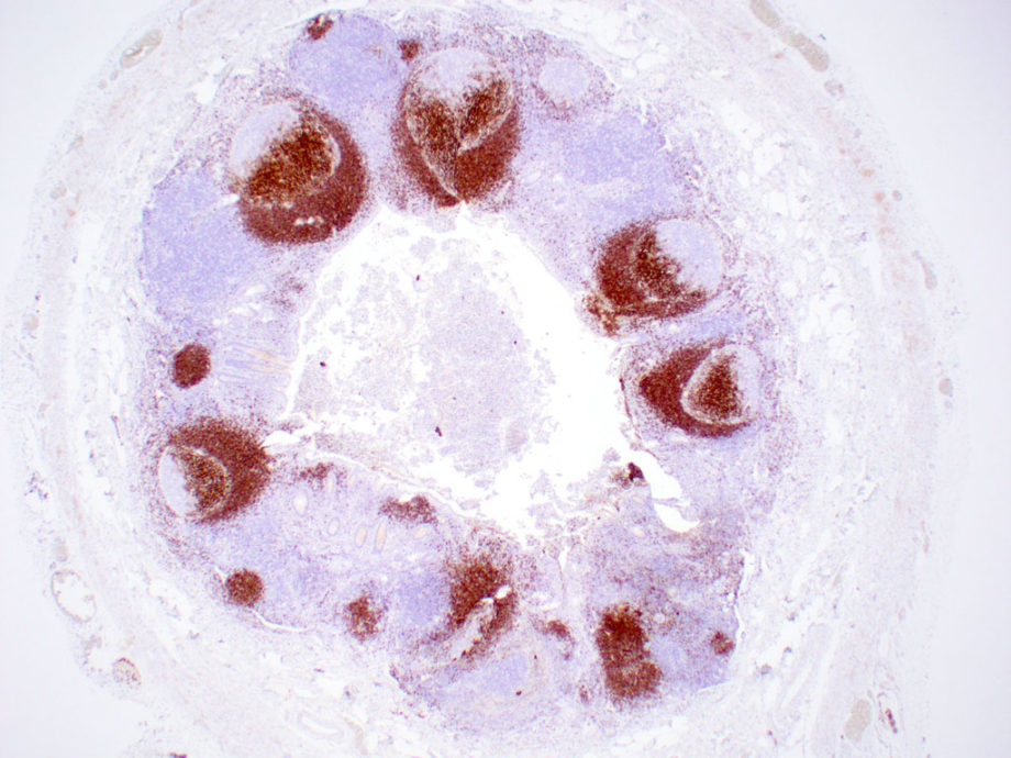 CD23 – Antibody Lexicon