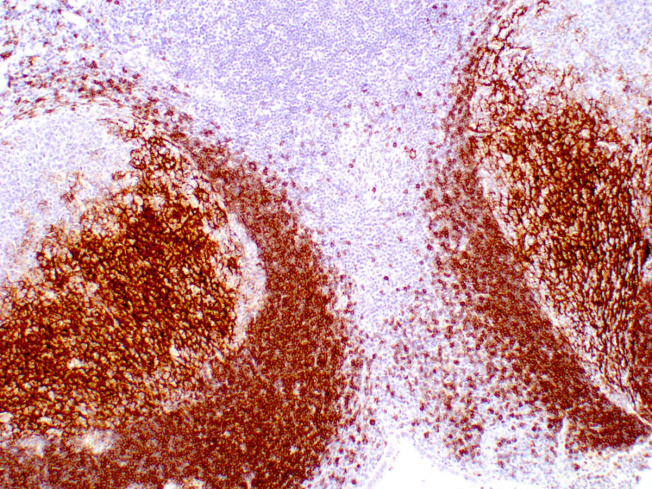 CD23 – Antibody Lexicon