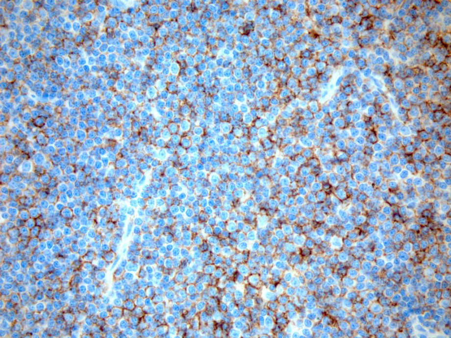 CD23 – Antibody Lexicon