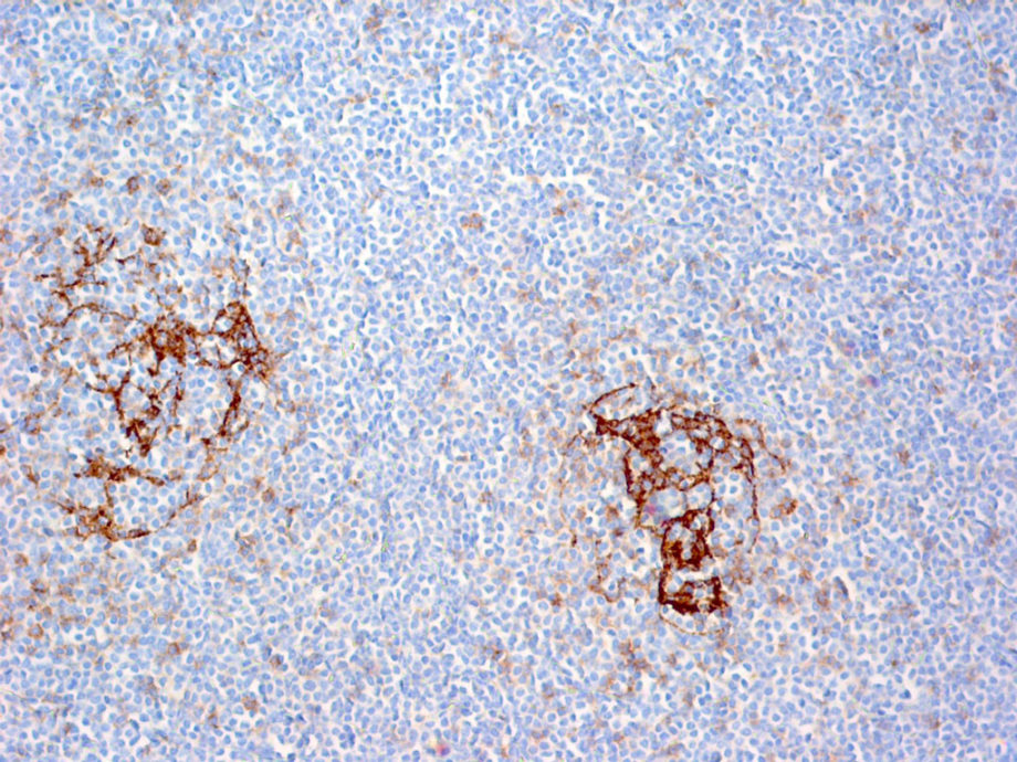 CD23 – Antibody Lexicon