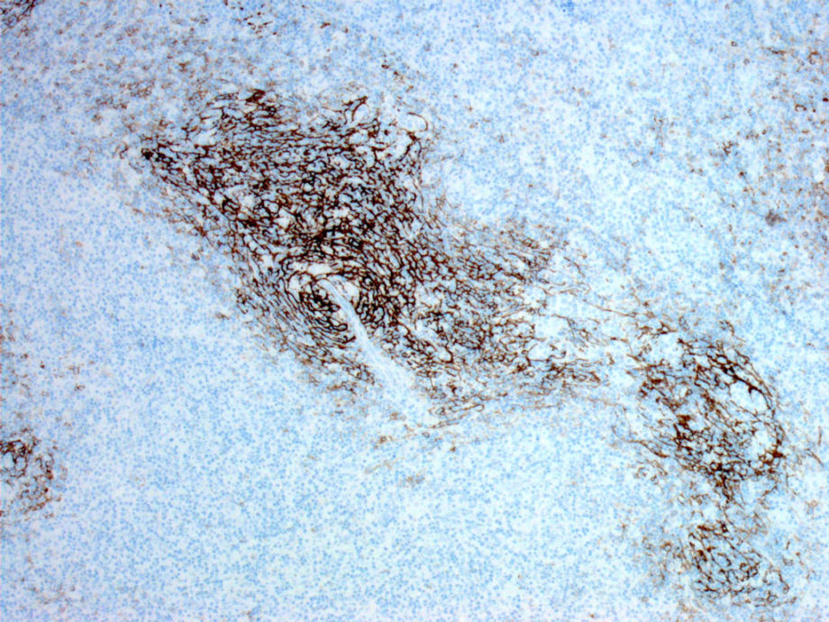 CD23 – Antibody Lexicon