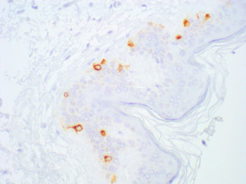 Melan-A – Antibody Lexicon