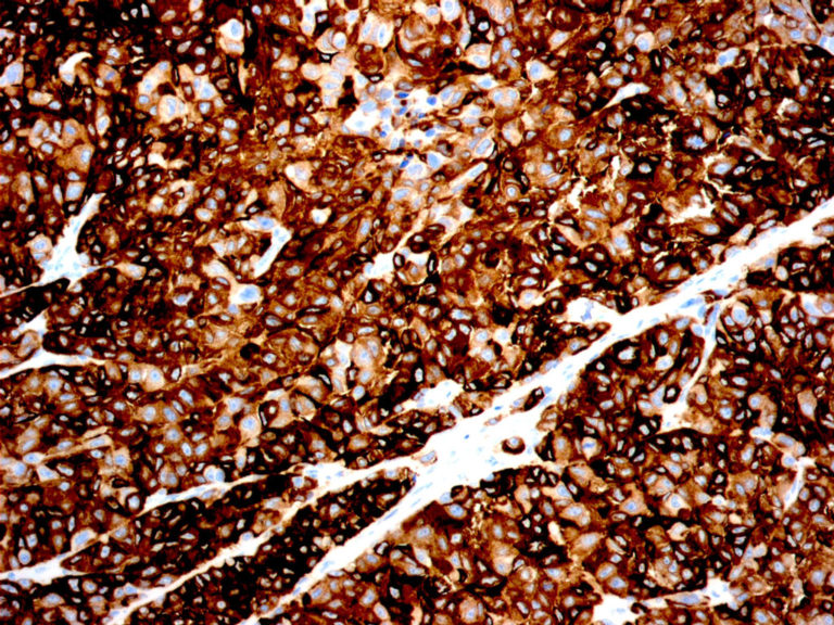 Melan-A – Antibody Lexicon