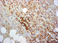 Melan-A – Antibody Lexicon